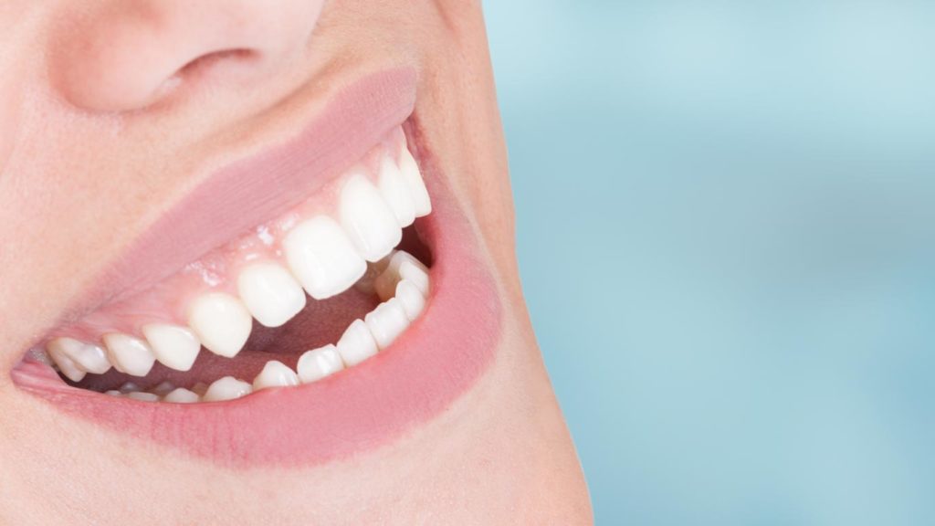 Hard & Soft Relines - Legacy Denture Clinic